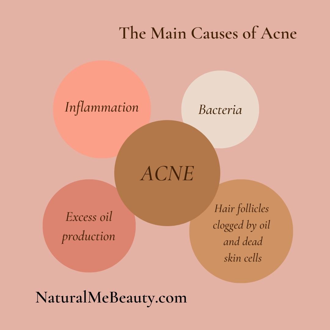 What's the difference between acne and blemishes? – Natural Me Beauty™